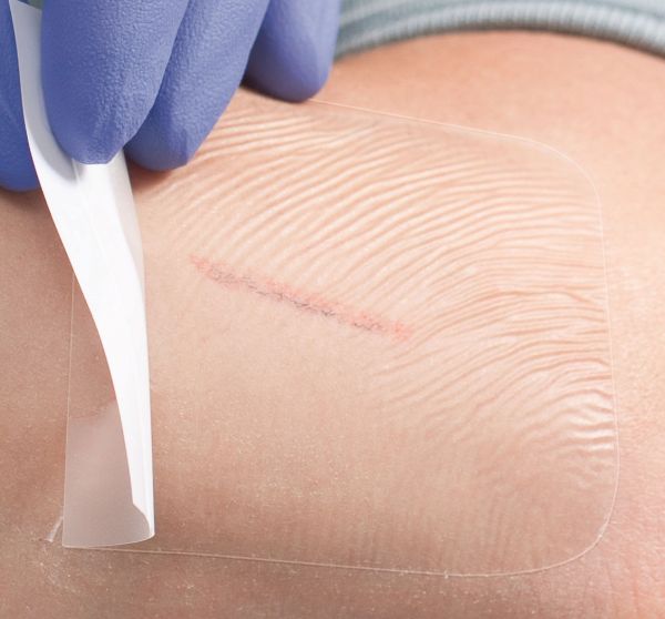 Wound Care - Acute Wound Care